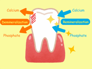 Rethinking Remineralization: Fluoride and Its Smart Alternatives for ...